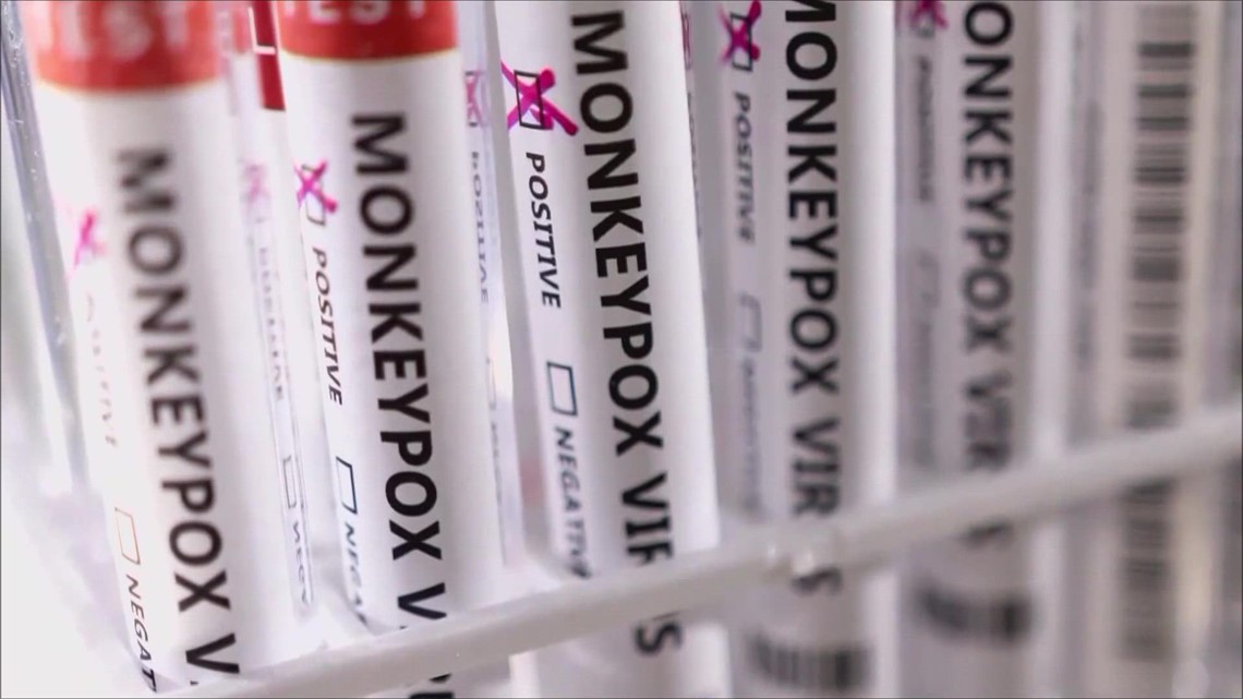 Indiana reports first possible case of monkeypox | whas11.com