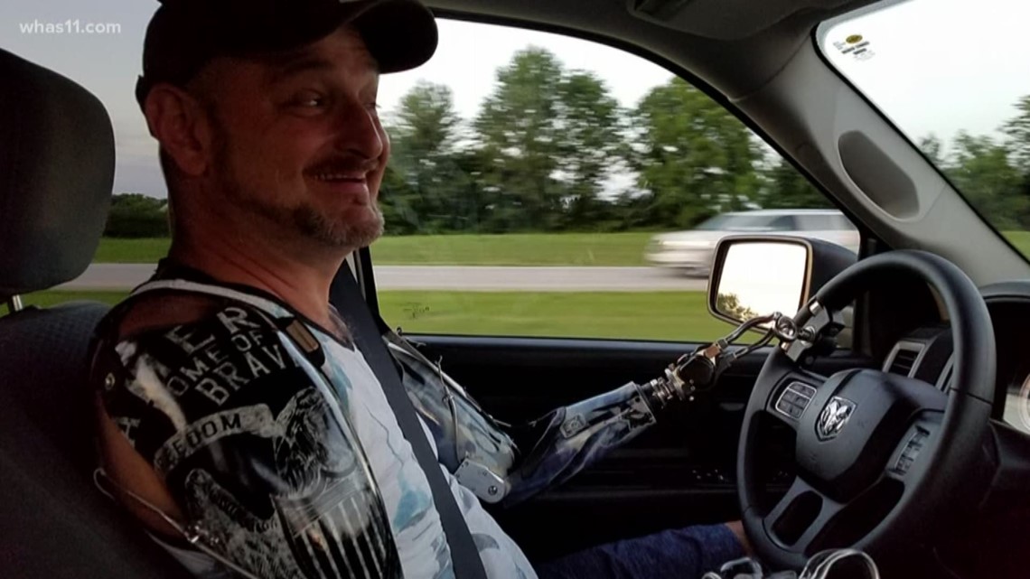 INTERVIEW: Amputee shares story through support group | whas11.com