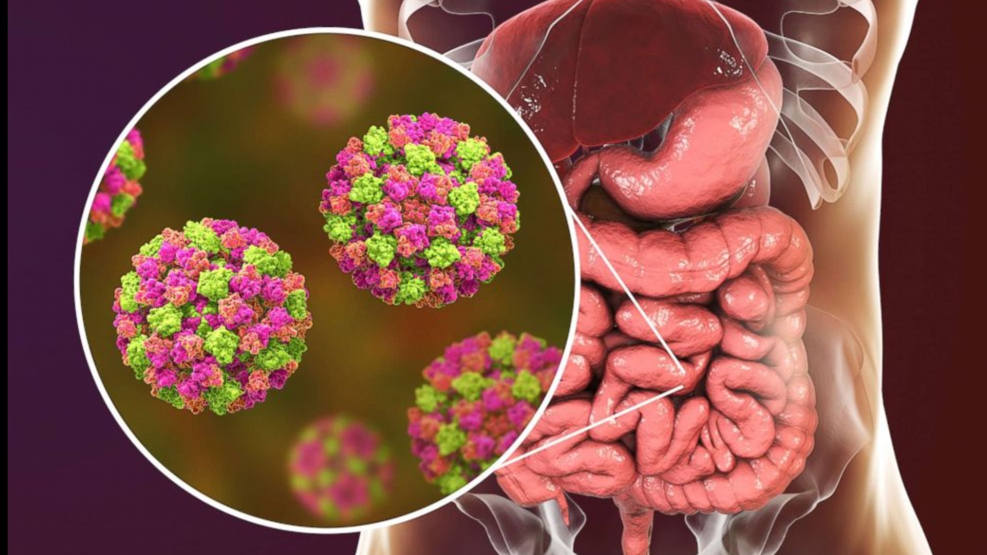 If You Have A stomach Flu Chances Are It s Actually Norovirus What