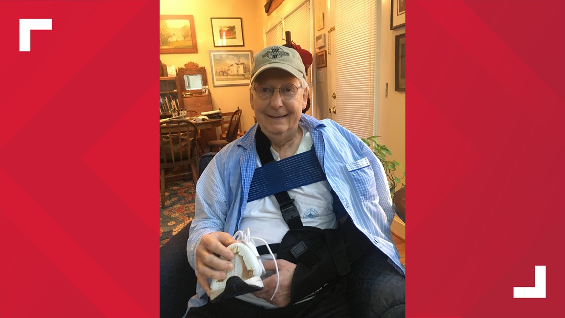 McConnell recovering from successful surgery to repair fracture ...