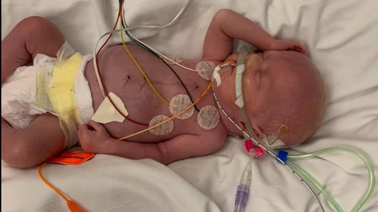 Meet the Louisville girl saved by the first tiny pacemaker | whas11.com