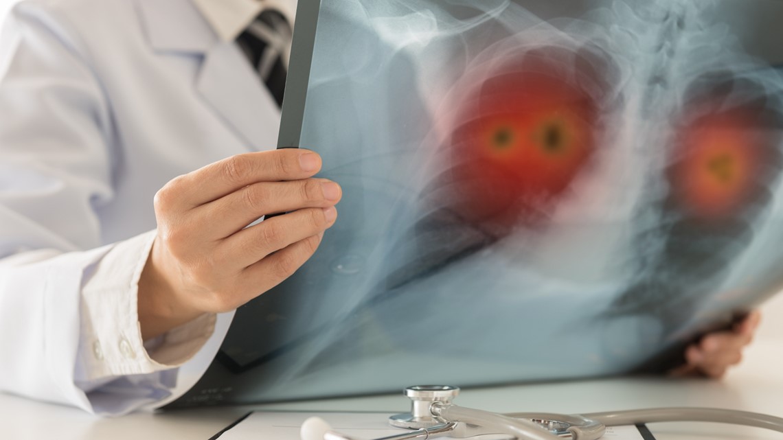 How metals can cause lung cancer, Louisville researcher says | whas11.com