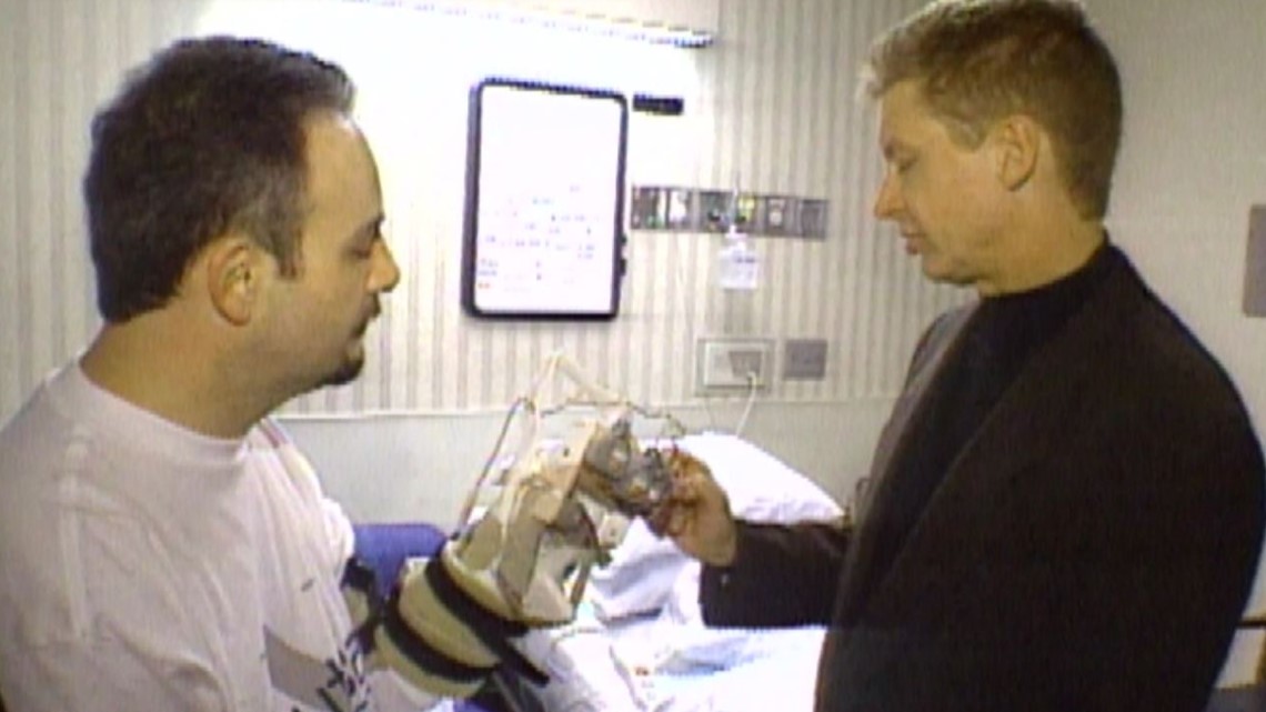 Revisiting the world's first hand transplant in Louisville | whas11.com
