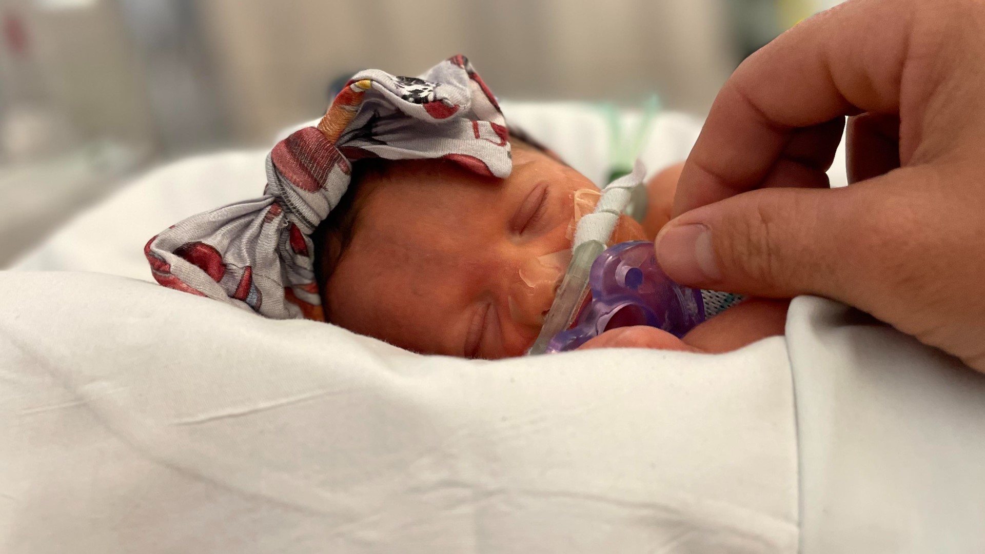 Norton Children's Epilepsy Monitoring Unit is back open | whas11.com