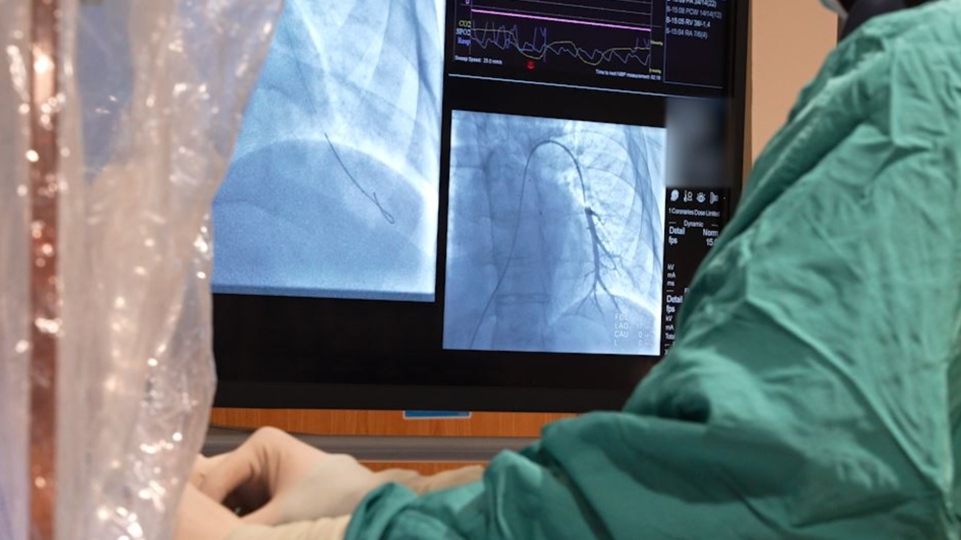 UofL Health-Heart Hospital celebrates 200th CardioMEMS procedure ...