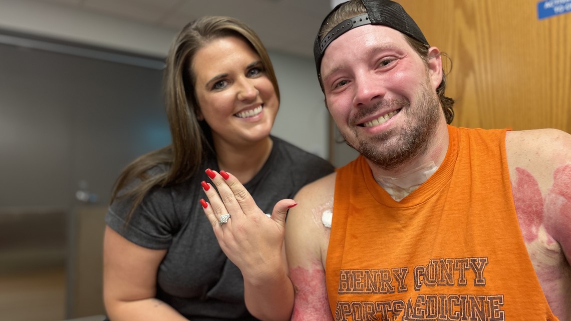 Burn survivor proposes to girlfriend at Ascension St. Vincent | whas11.com