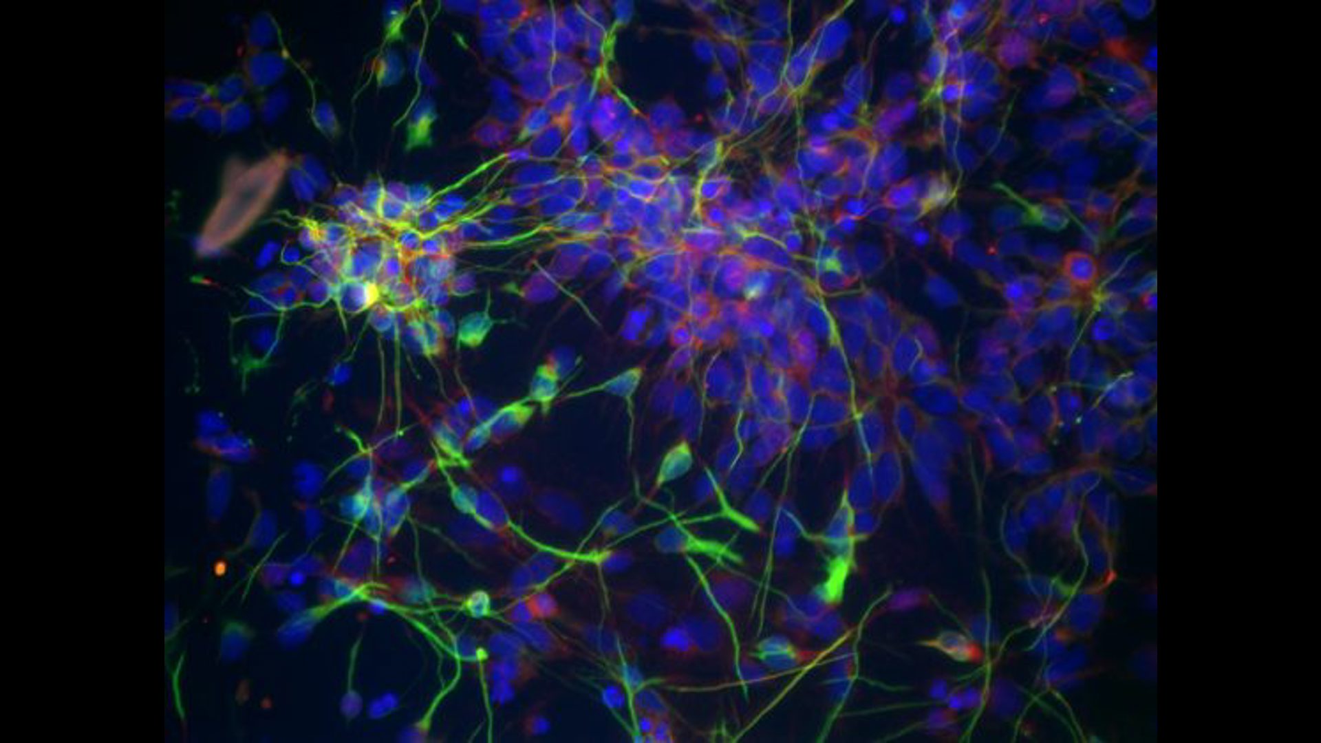 UConn’s Dr. Levine receives $400K for autism research from Philadelphia ...
